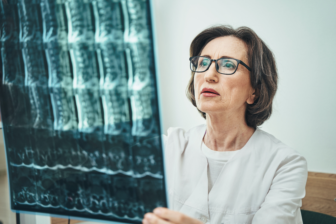 Bone Health – the ‘Silent Disease’ - GrownUps New Zealand